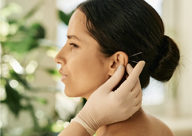 Collective Healing Energy In Community Acupuncture - Therapy Unlimited